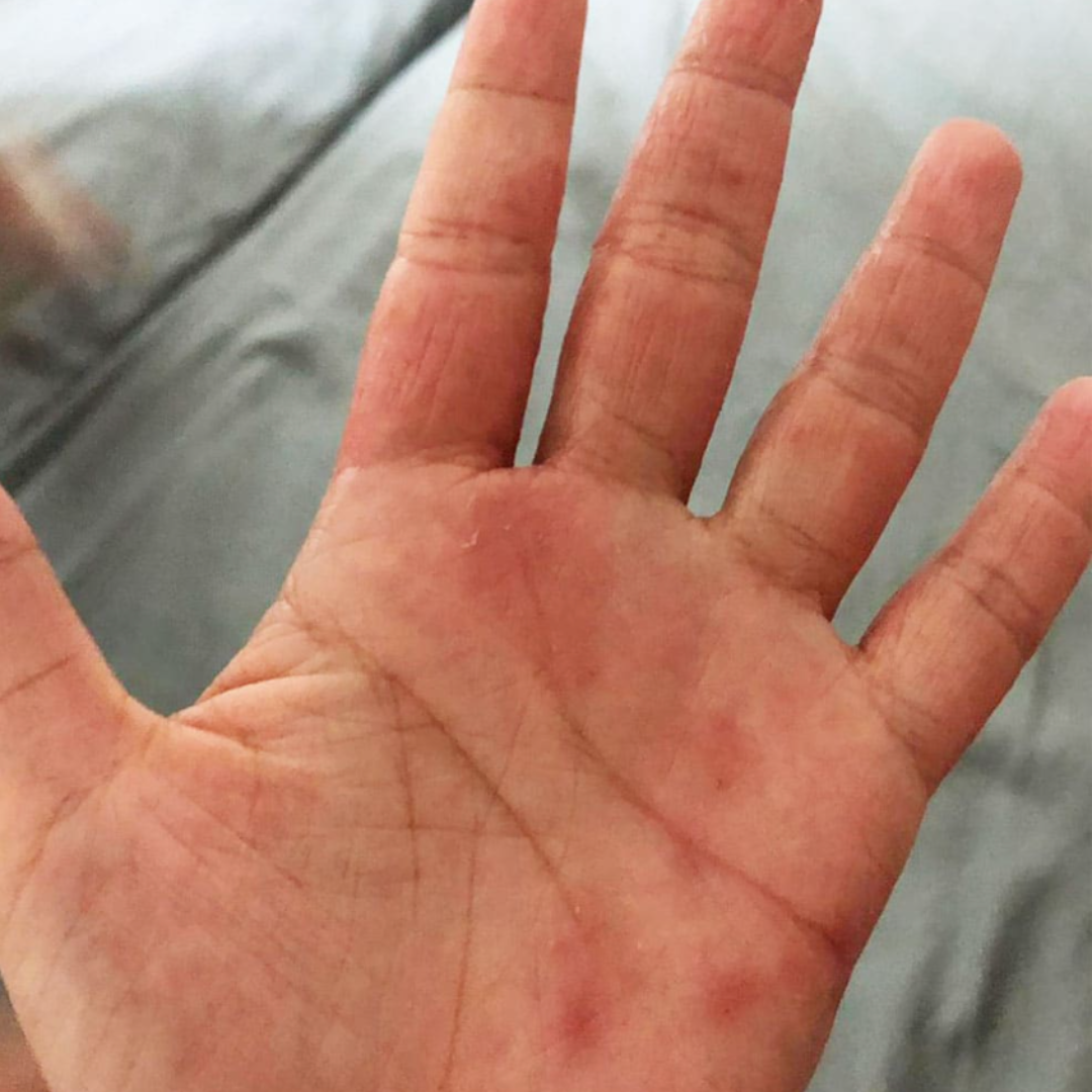 Advanced Skin Repair Balm – BeKynd Beauty