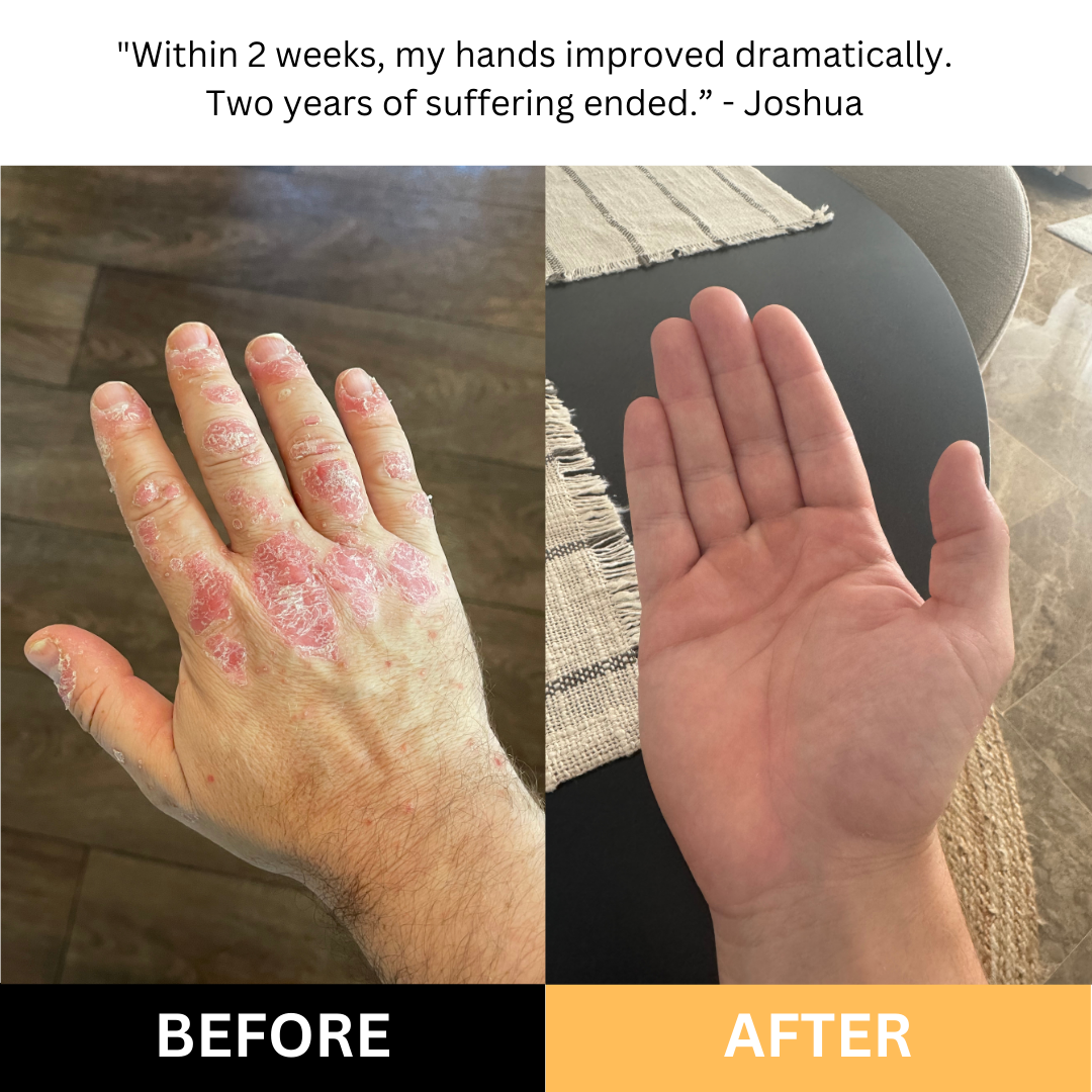 Advanced Skin Repair Balm – BeKynd Beauty